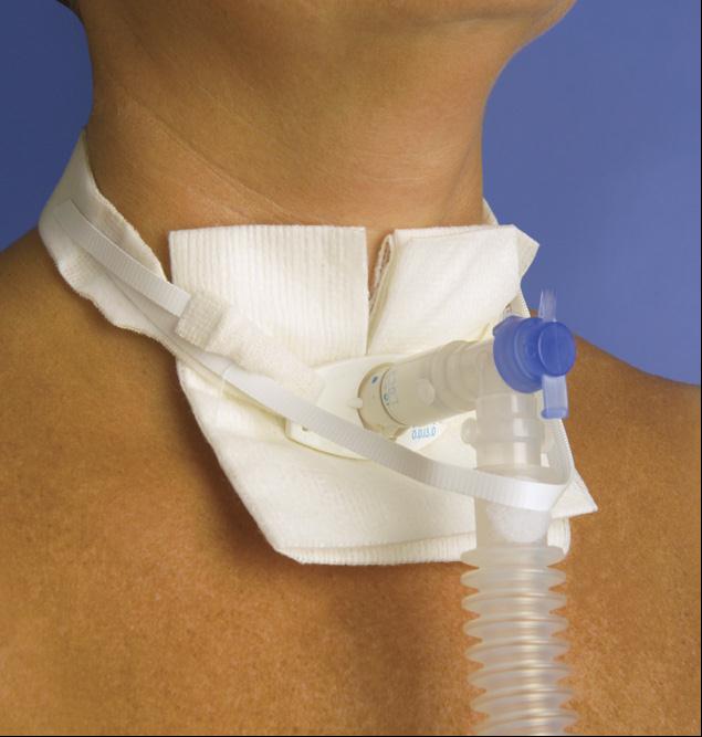 One-Piece Adult Trach-Tie with Ventilator Anti-disconnect Device | Angel